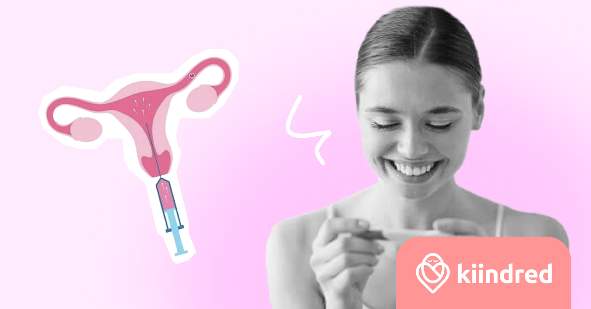Intrauterine Insemination Procedure and Success Rate - Kiindred
