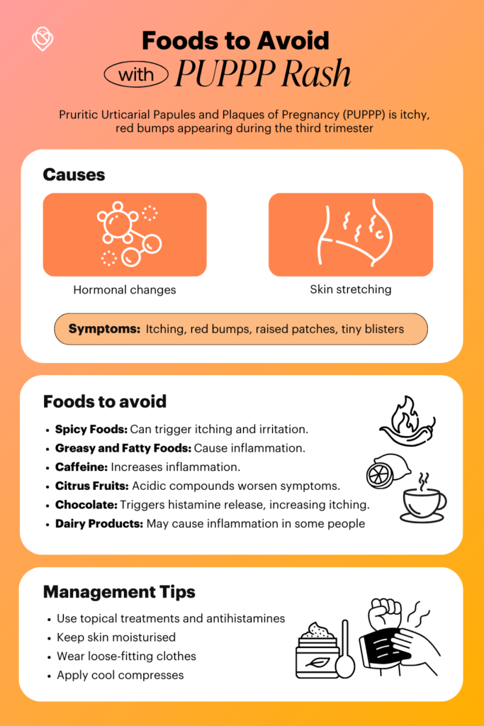 Foods to Avoid with PUPPP Rash in Pregnancy: Your Diet Guide | Kiindred