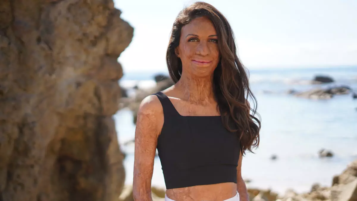 Turia Pitt’s top 5 tips for returning to running after having a baby ...