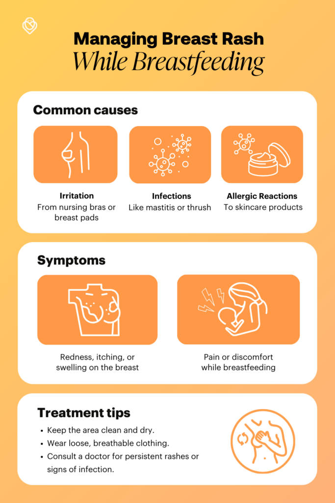 Breastfeeding Rash Causes & Treatments Every Parent Should Know