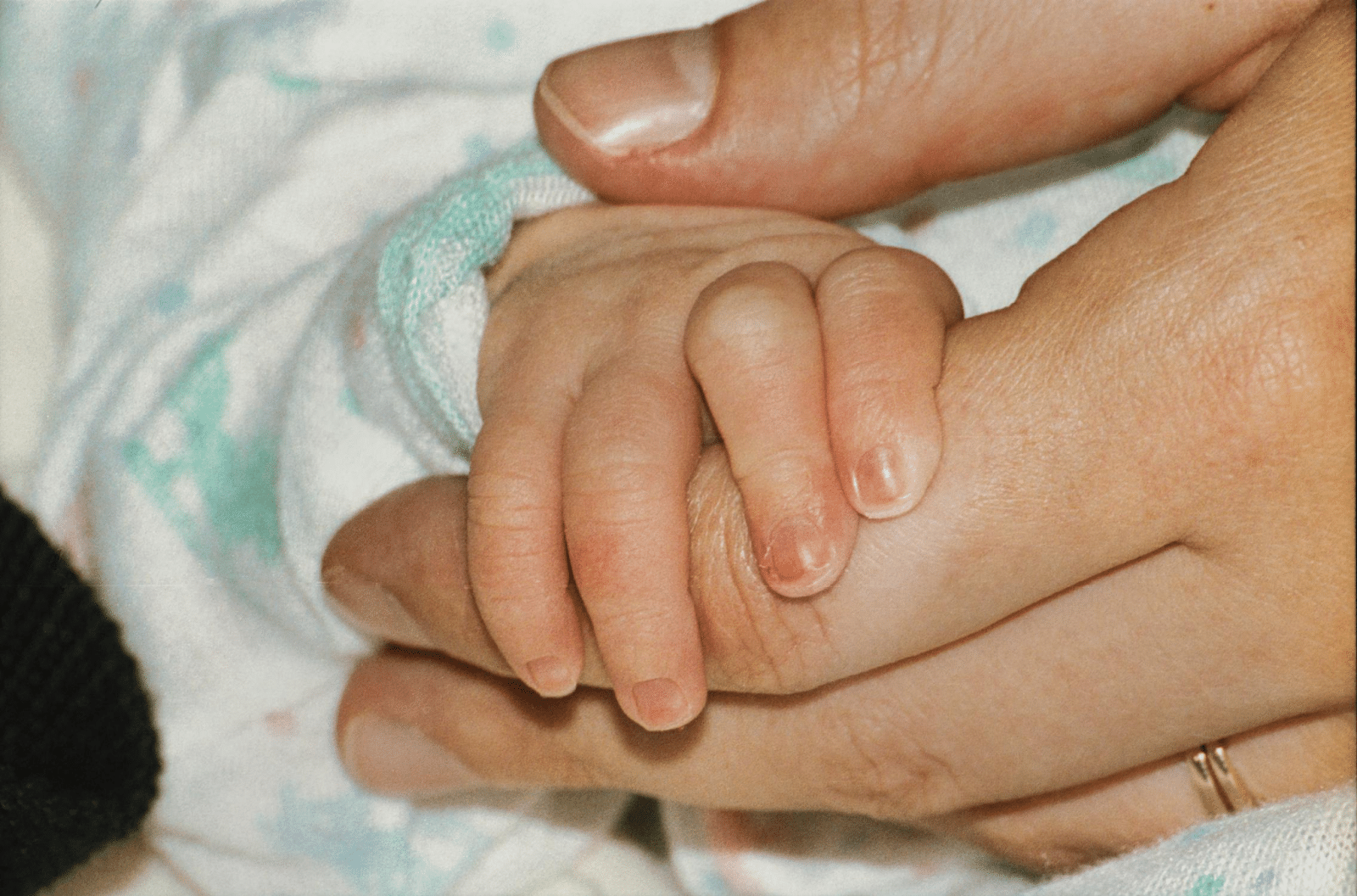 Our top tips on how to handle your baby’s delicate skin with care ...